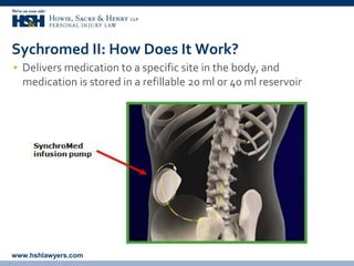 Do You Rely on the Synchromed II Pain Pump For Drug Delivery? Beware of ...