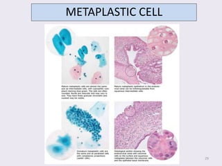 Bethesda Cervical CYtology | PPTX