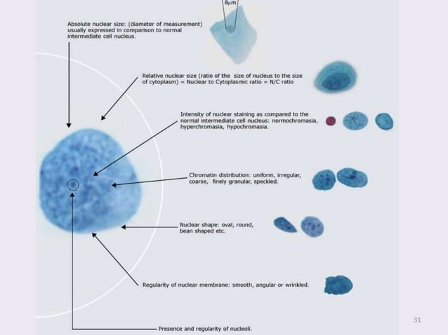 Bethesda Cervical CYtology | PPTX