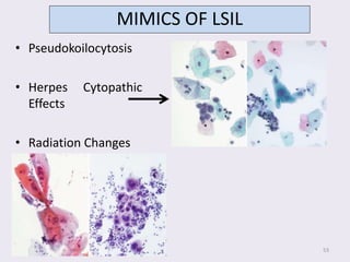 Bethesda Cervical CYtology | PPTX