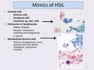 Bethesda Cervical CYtology | PPTX