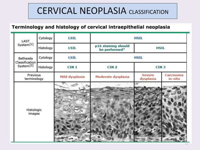 Bethesda Cervical CYtology