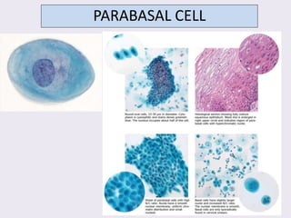 Parabasal Cell