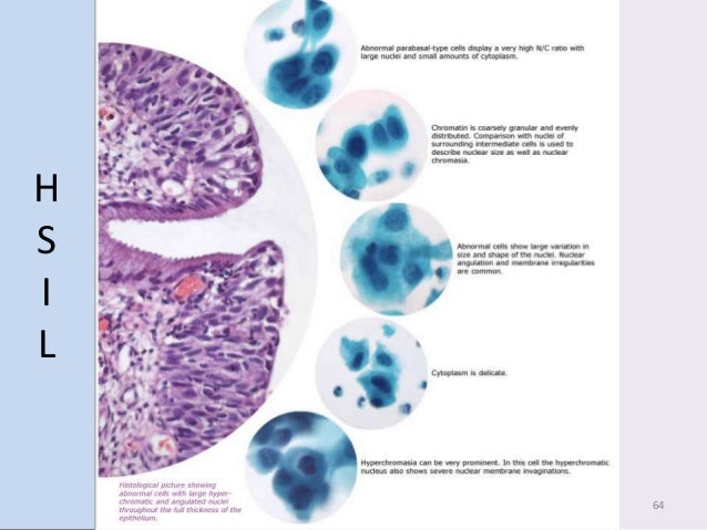 Bethesda Cervical CYtology