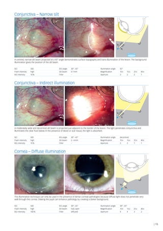 Haag-Streit Diagnostics Slit Lamp Imaging Guide | PDF