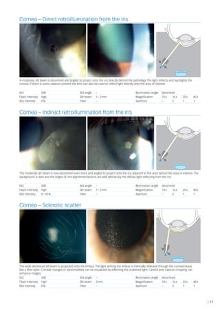 Haag-Streit Diagnostics Slit Lamp Imaging Guide | PDF