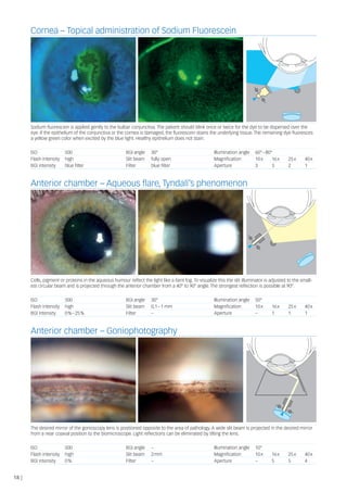 Haag-Streit Diagnostics Slit Lamp Imaging Guide | PDF