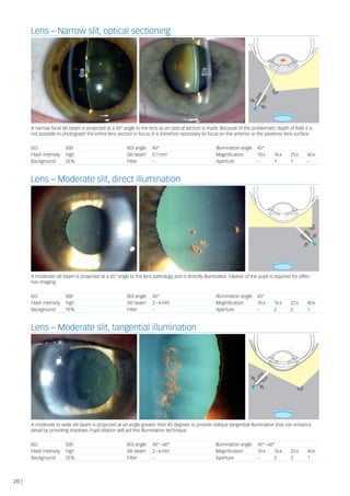 Haag-Streit Diagnostics Slit Lamp Imaging Guide | PDF