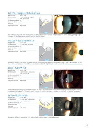 Haag-Streit Diagnostics Slit Lamp Imaging Guide | PDF
