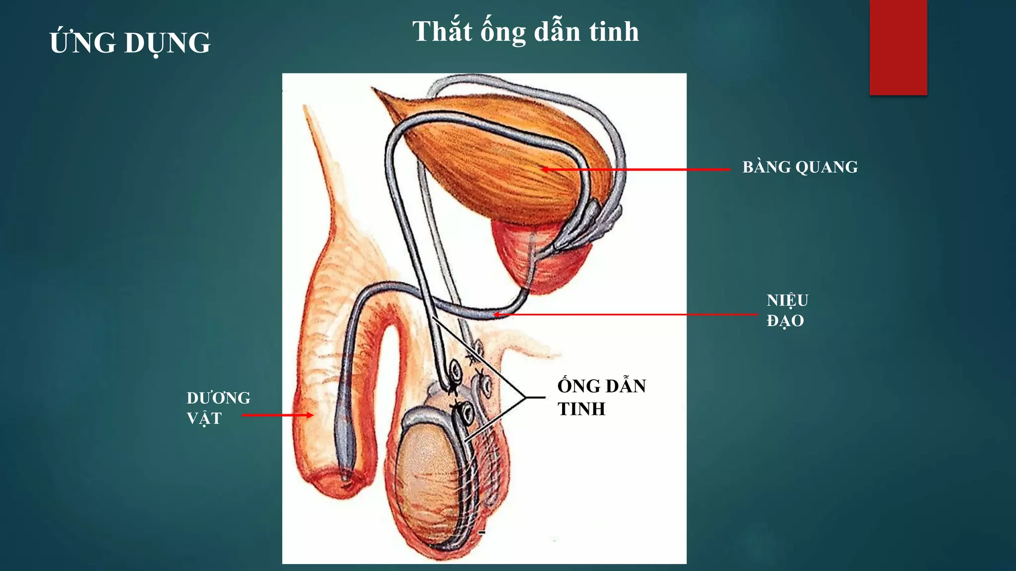Hệ sinh dục nam | PPTX