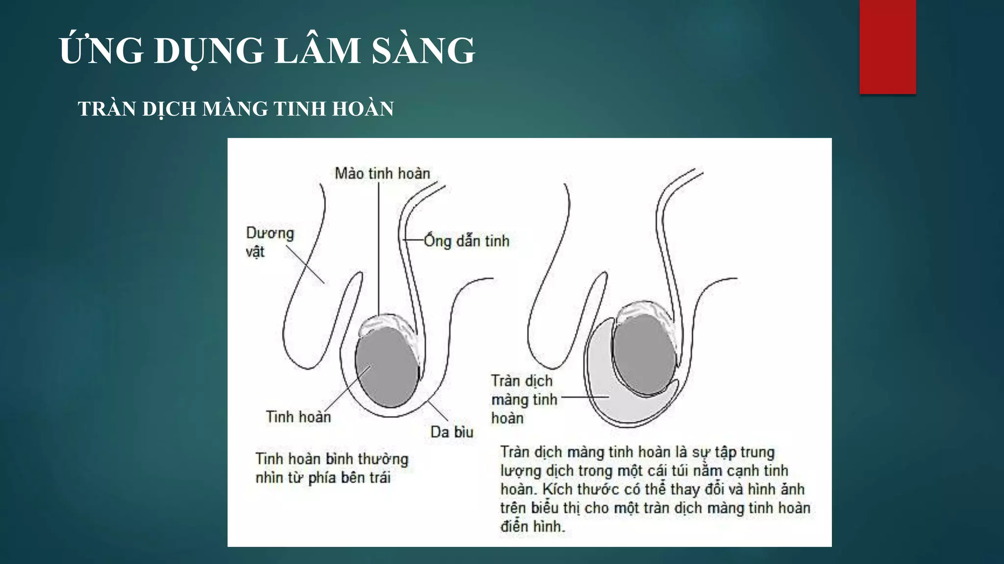 Hệ sinh dục nam | PPTX