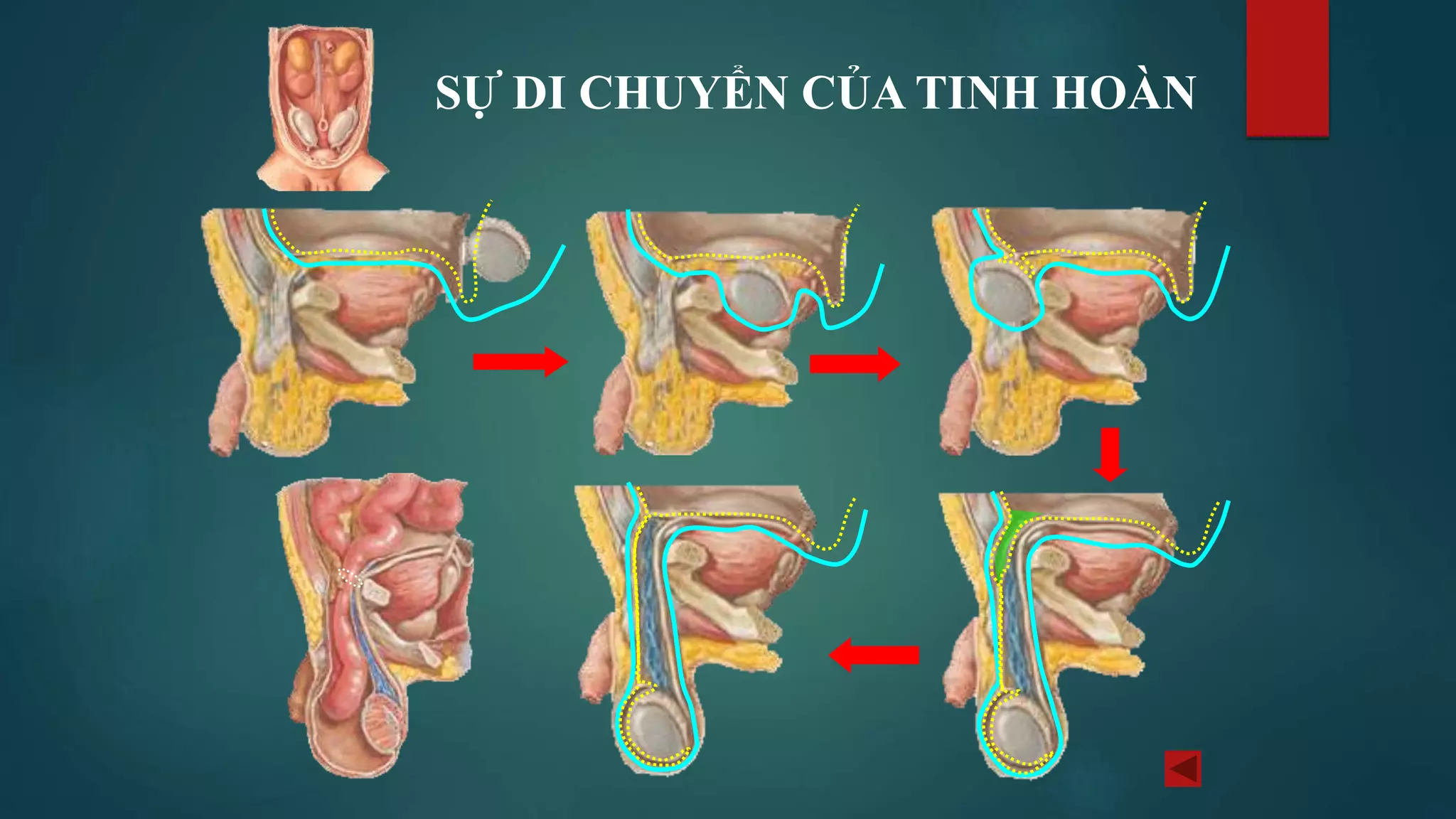Hệ sinh dục nam | PPTX