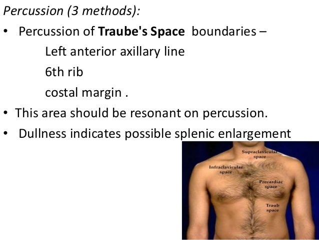 Hepato&spleenomegaly
