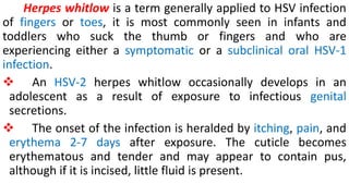 Hsv , mazin malik | PPTX