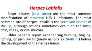 Hsv , mazin malik | PPTX