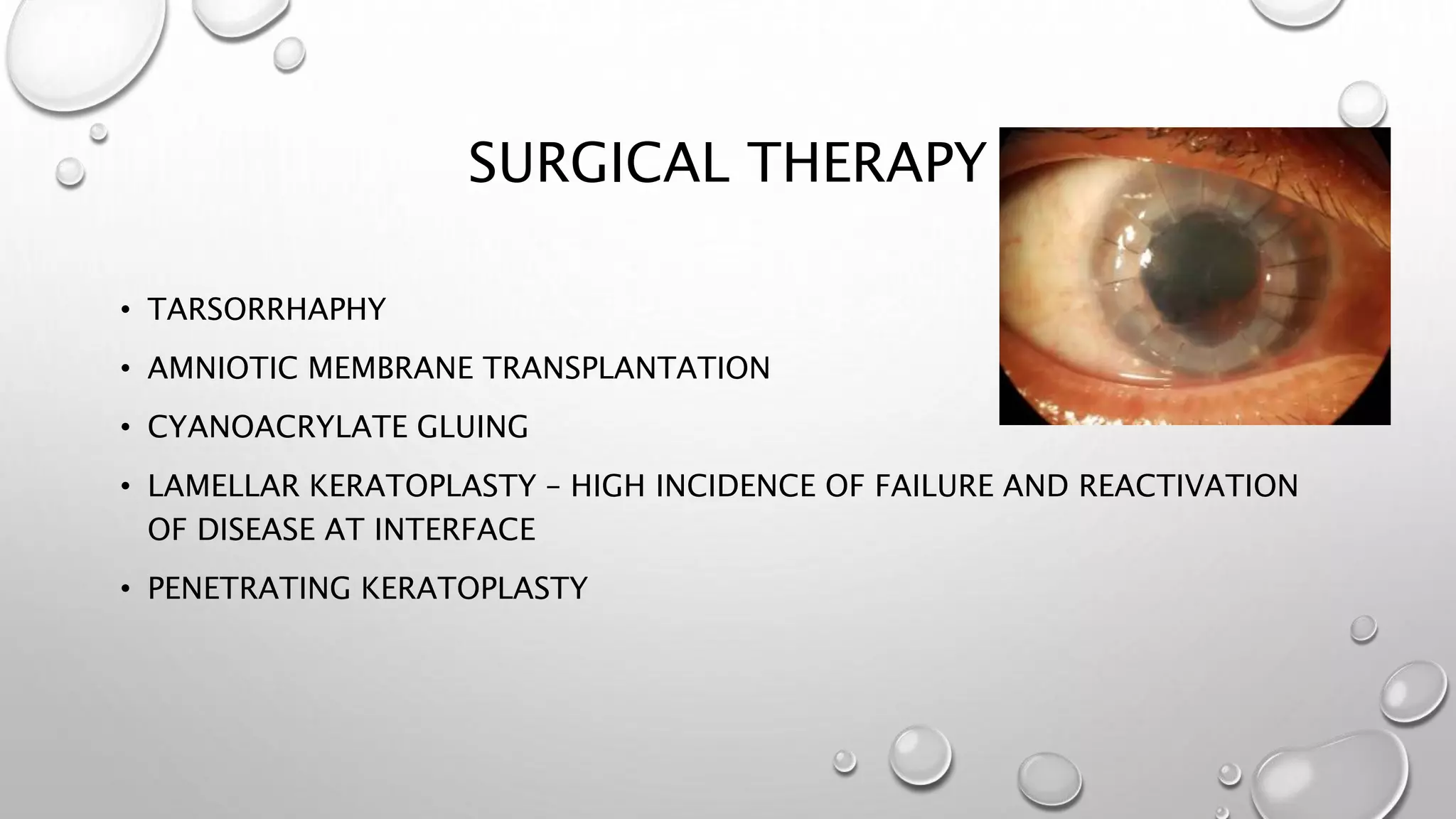 HSV keratitis | PPTX