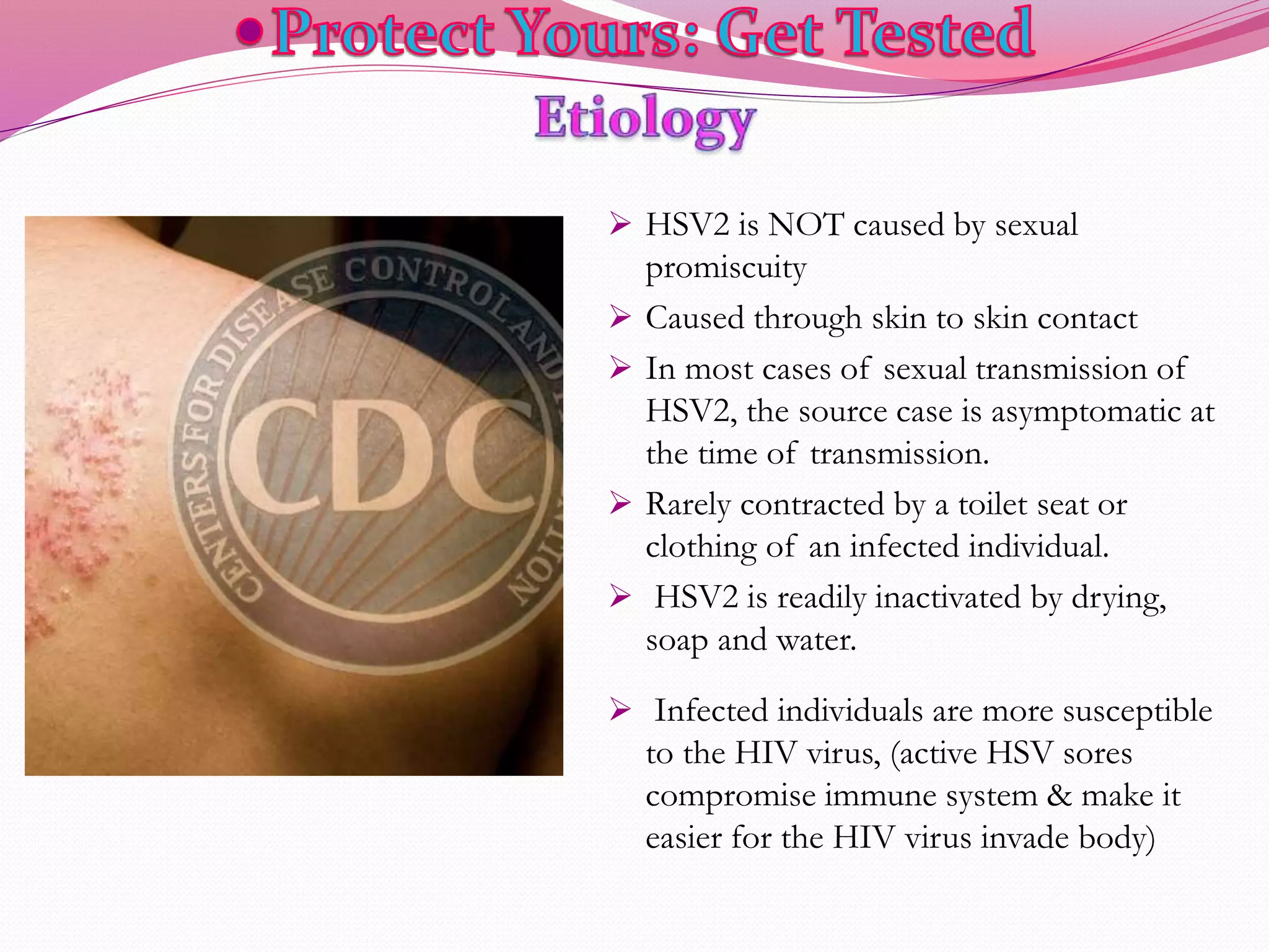 HSV1 & HSV2 Genital Herpes | PPTX