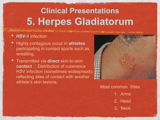 Herpes Gladiatorum