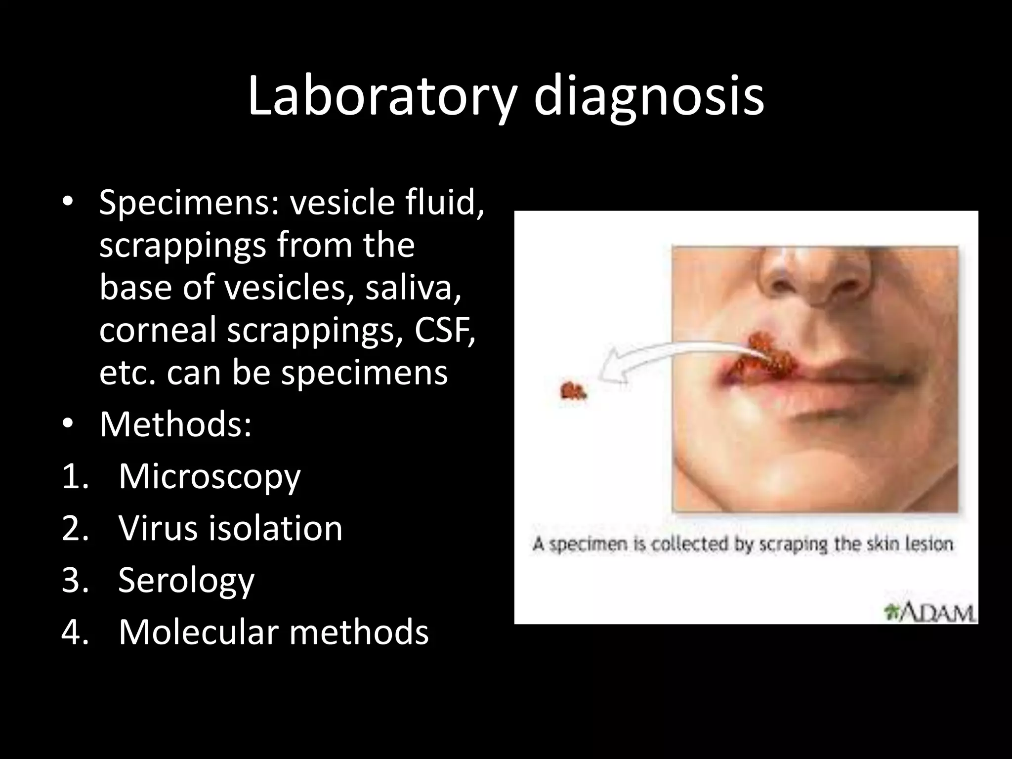 Herpes Simplex Virus (HSV) and Varicella Zoster Virus (VZV) by Dr ...