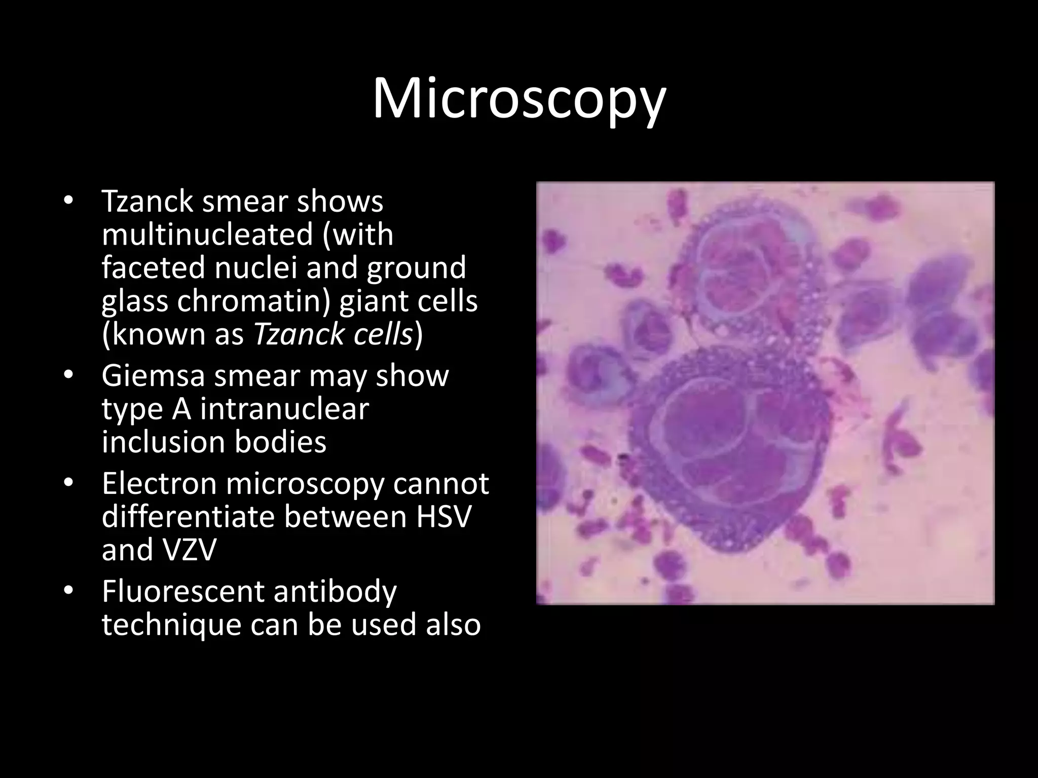 Herpes Simplex Virus (HSV) and Varicella Zoster Virus (VZV) by Dr ...