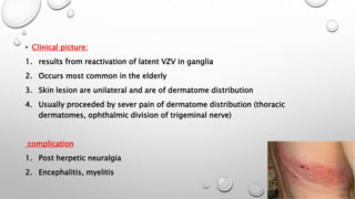 Hsv,ebs,cmv and hzv | PPTX