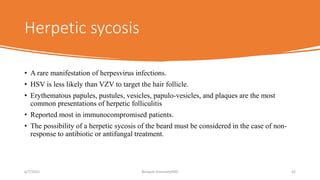 Hsv infections(cutaneous and genital) | PPTX
