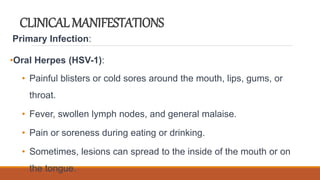 HERPES SIMPLEX VIRUS INFECTIONS PPT.pptx | Infectious Diseases ...