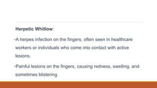 HERPES SIMPLEX VIRUS INFECTIONS PPT.pptx | Infectious Diseases ...