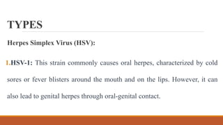 HERPES SIMPLEX VIRUS INFECTIONS PPT.pptx | Infectious Diseases ...