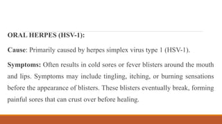 HERPES SIMPLEX VIRUS INFECTIONS PPT.pptx