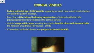 HSV KERATITIS . CLINICAL FEATURES , TYPES , DIAGNOSIS , TREATMENT ...