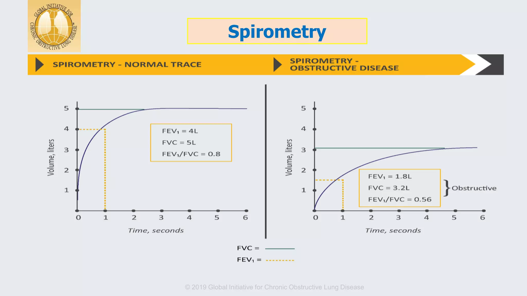 Brief summary on gold 2019 guidelines on copd | PPTX