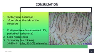 Hair Transplantation - Dr Mujtuba Pervez Khan | PPTX