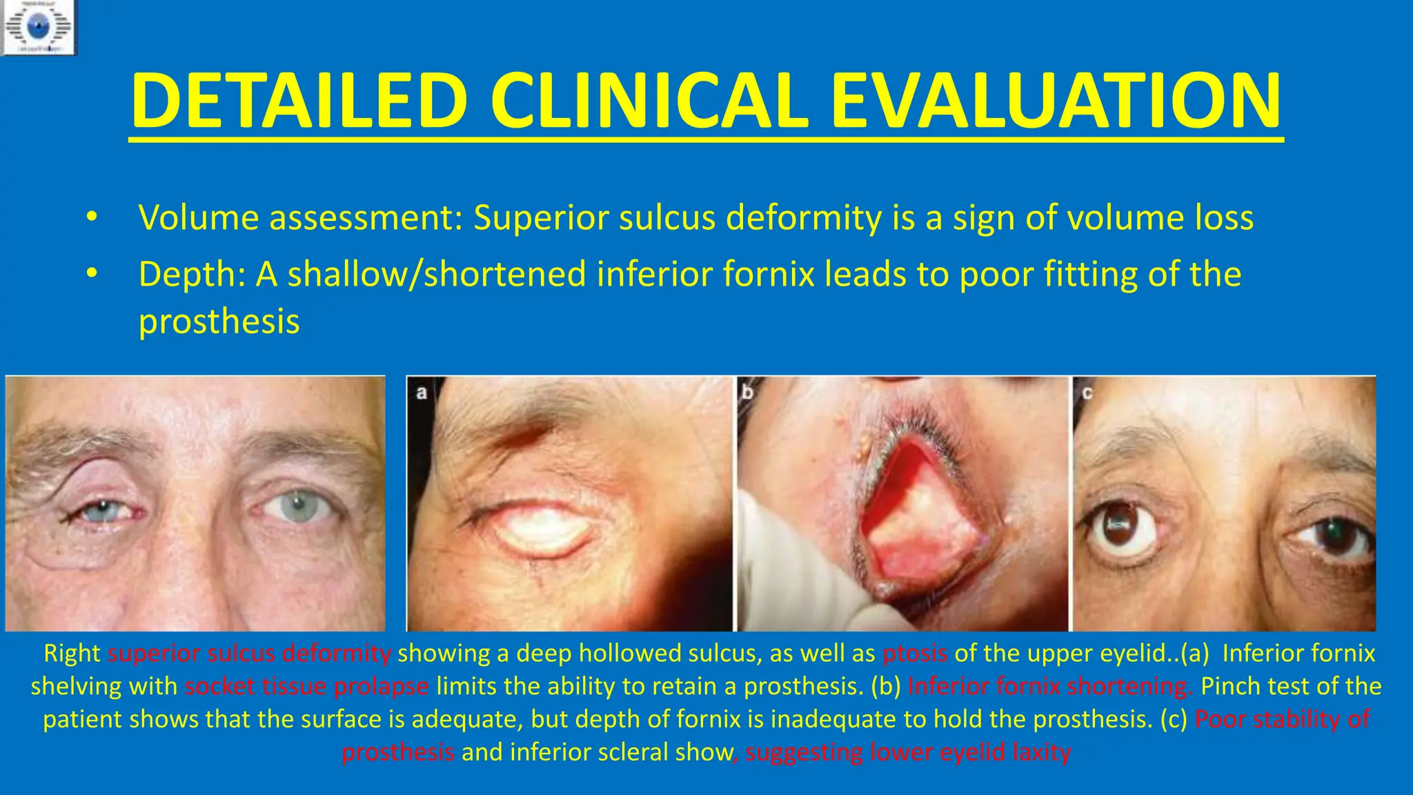 CONTRACTED_SOCKET presentation DHB .pptx