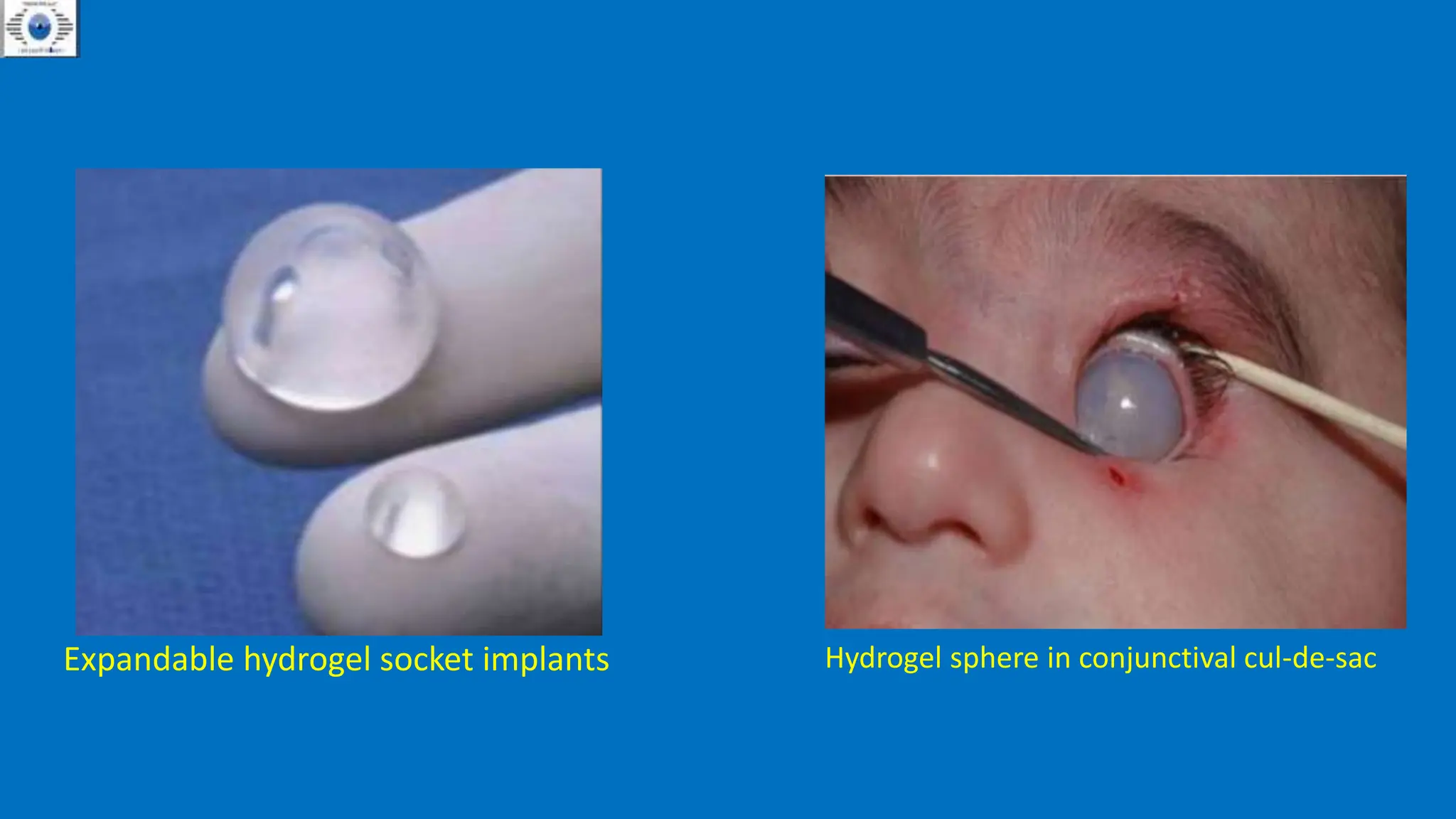CONTRACTED_SOCKET presentation DHB .pptx