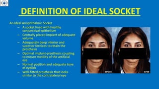 CONTRACTED_SOCKET presentation DHB .pptx