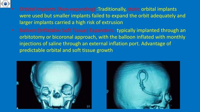 CONTRACTED_SOCKET presentation DHB .pptx