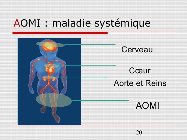 Dr Hitache HTA et AOMI