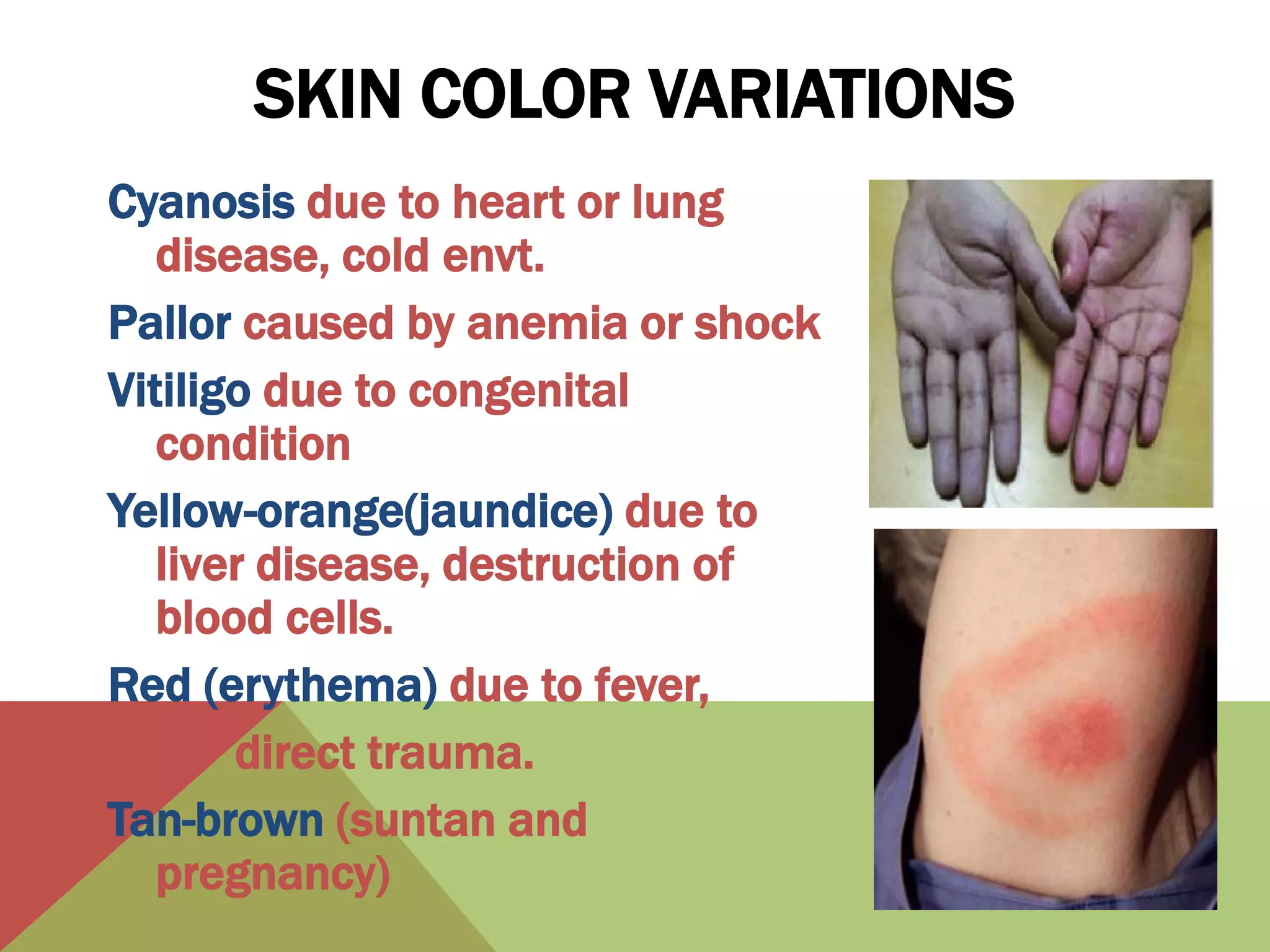 HT AND PHYSICAL EXAMINATION.pptx
