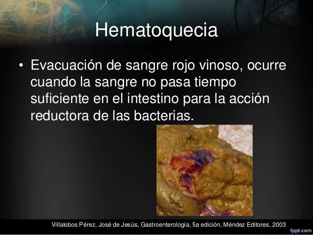 Hemorragia digestiva