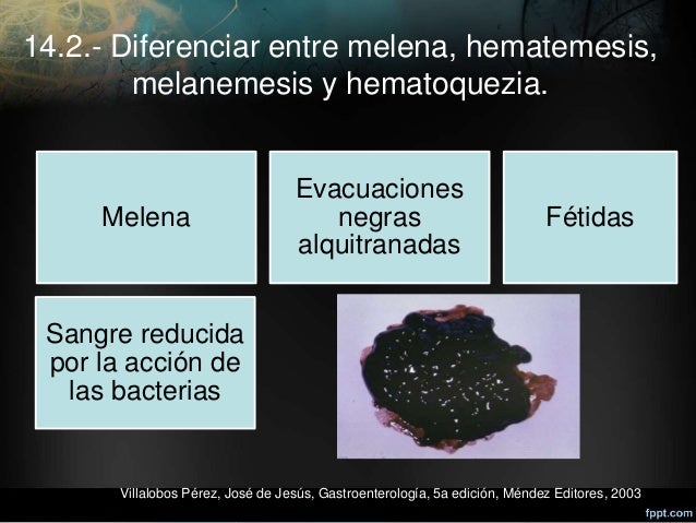 Hemorragia digestiva