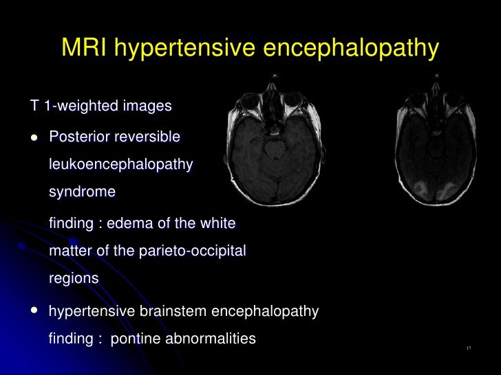 Ht emergency 2011 v2003