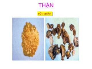 Hệ tiết niệu | PPT