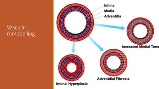 Pathology of Hypertension | PPTX