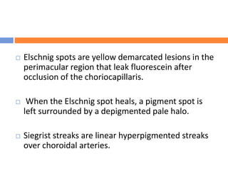 HYPERTENSIVE RETINOPATHY.pptx