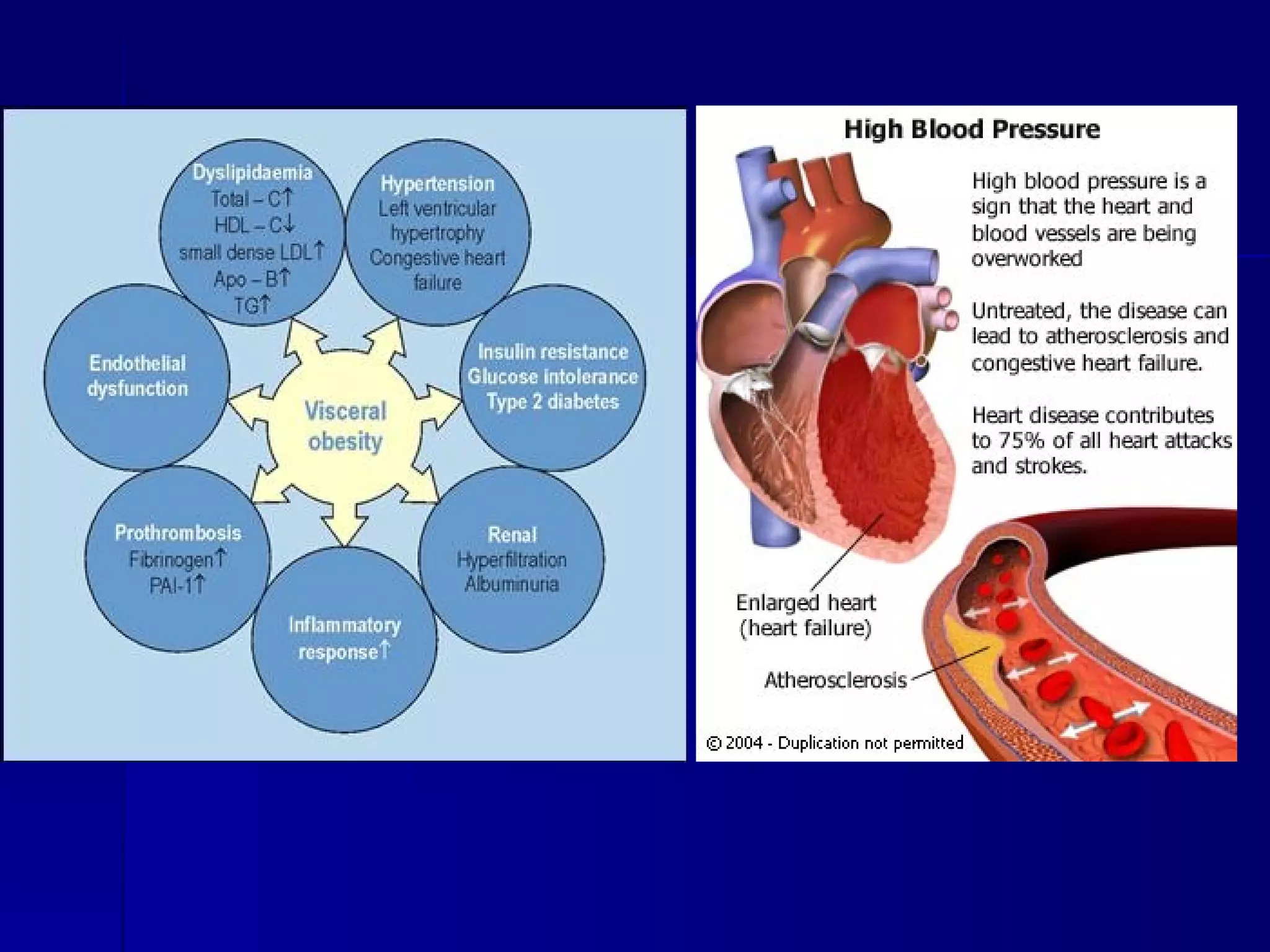 ppt.Hypertension and Exercise | PPT
