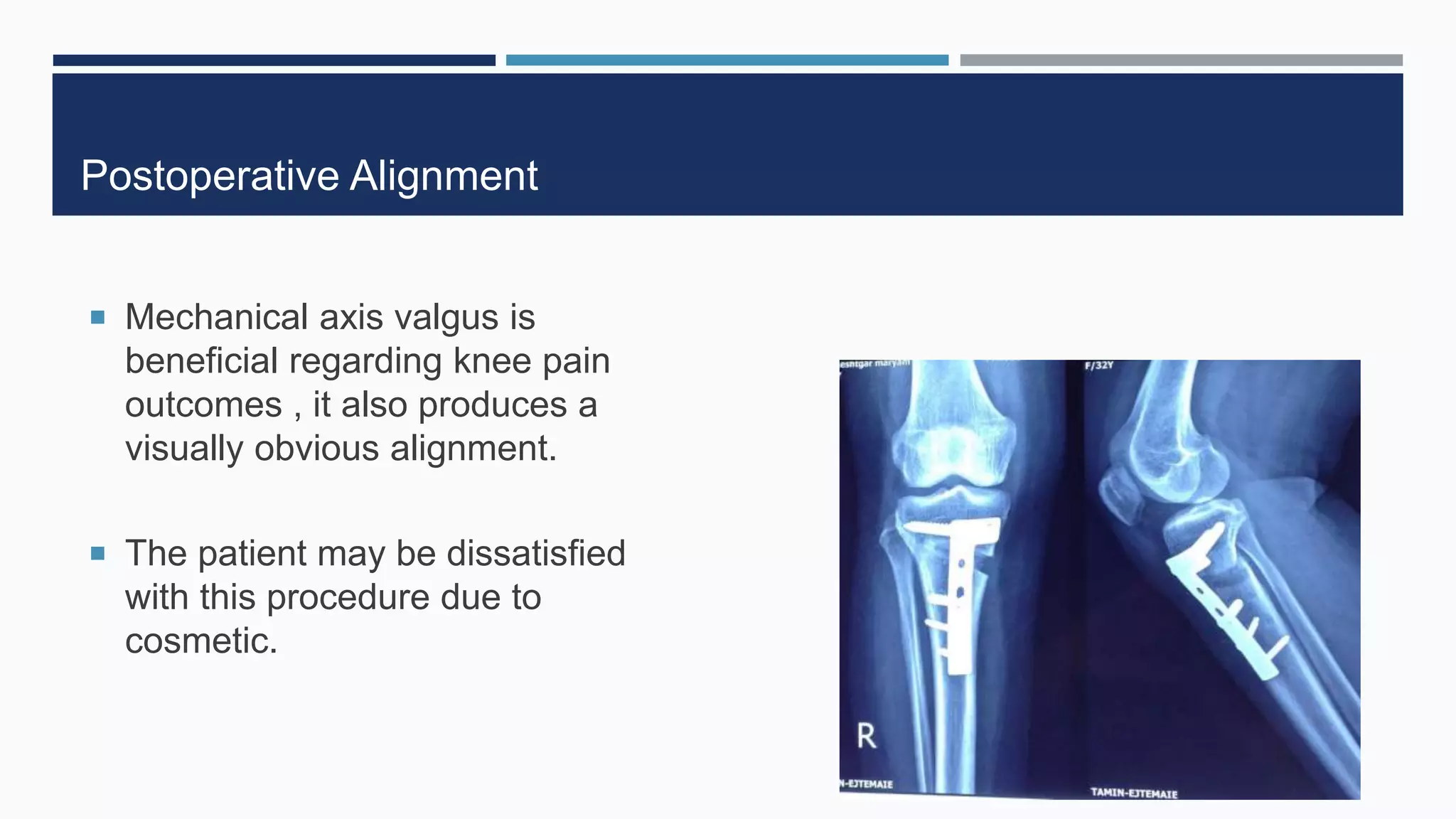 High tibial osteotomy- All you need to know | PPTX | Death, Injury, or ...