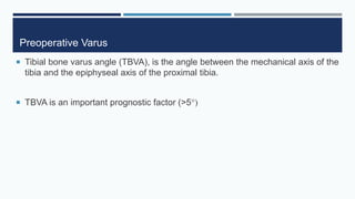 High tibial osteotomy- All you need to know | PPTX