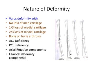 HIgh Tibial Osteotomy: when and how | PPTX