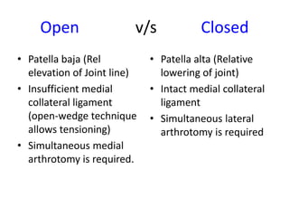 HIgh Tibial Osteotomy: when and how | PPTX